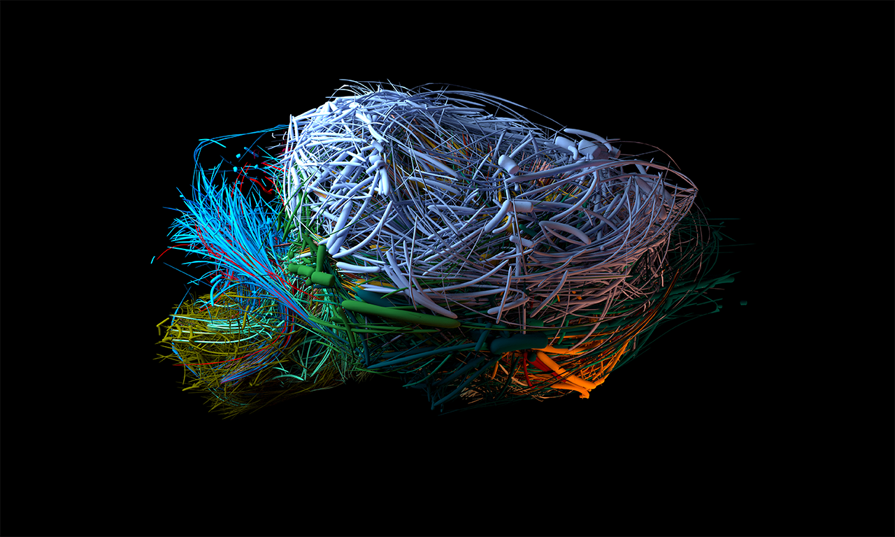 Barabasi Lab Science Project Brain Networks